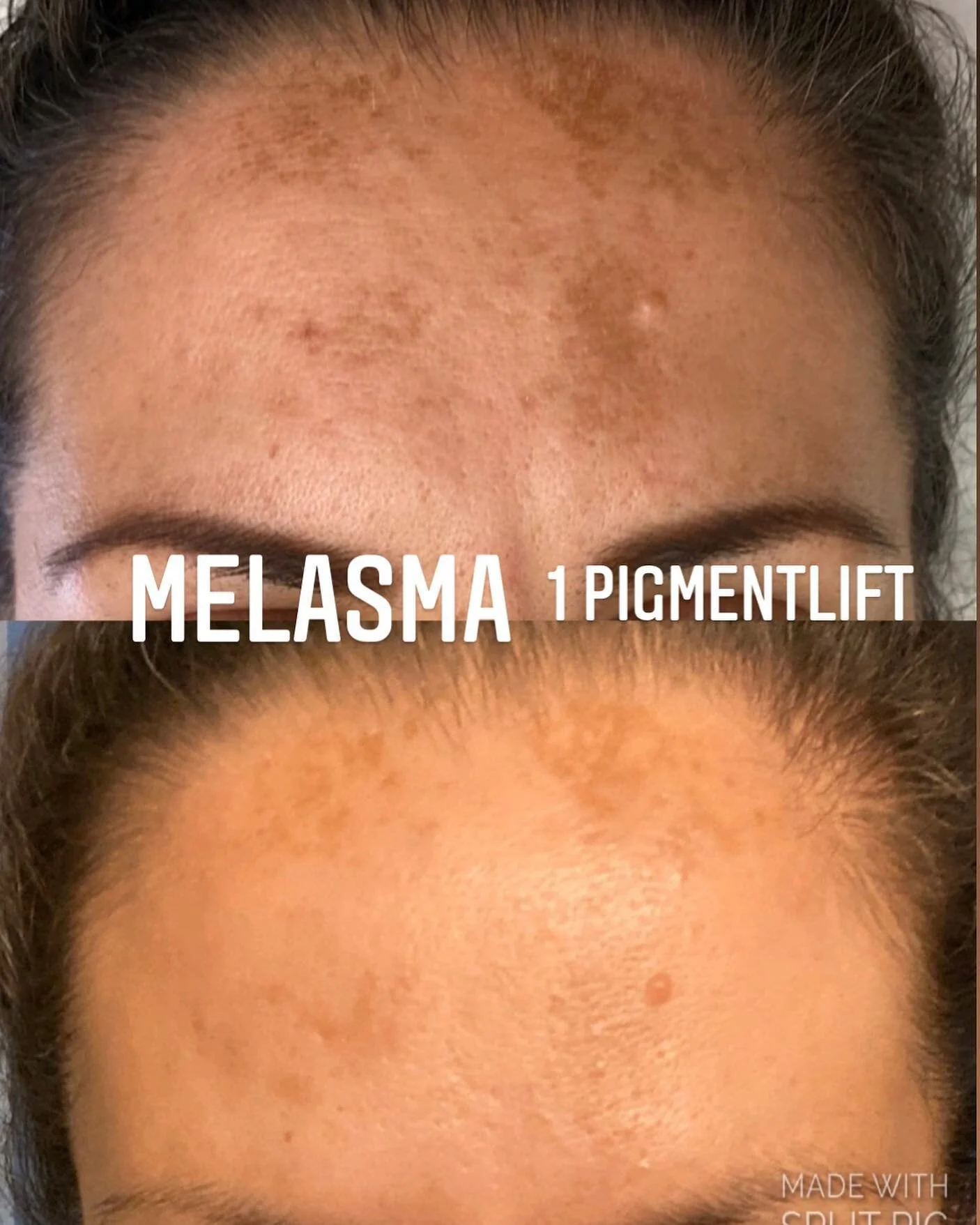 The Peel Connection® | Just Peels!