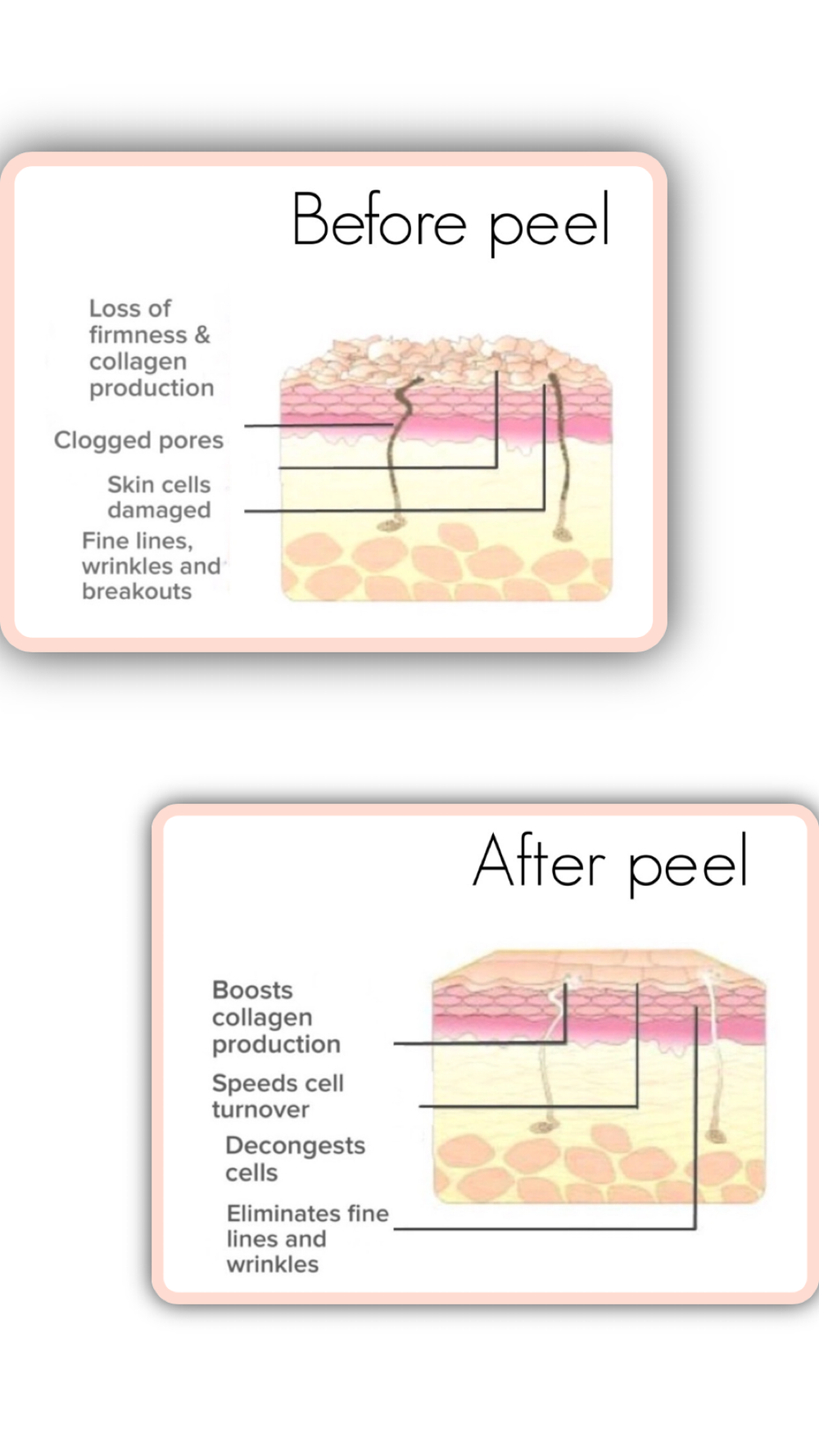 The Peel Connection® | Just Peels!
