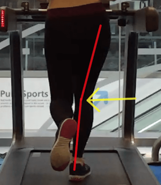 Running or Walking Gait Impairments — Fit For Life