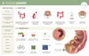 Types of Cancer Infographics — Hope & Beauty