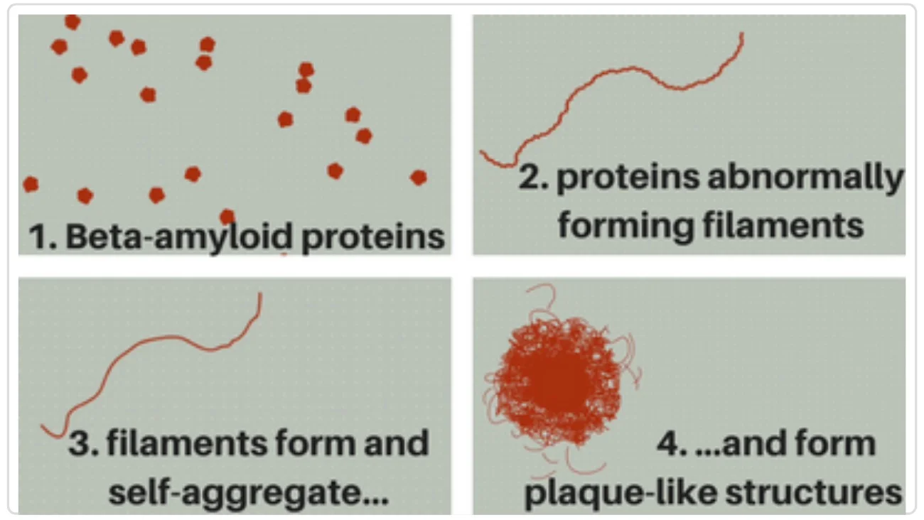 An Introduction to Alzheimer's Disease. — Andréas Astier