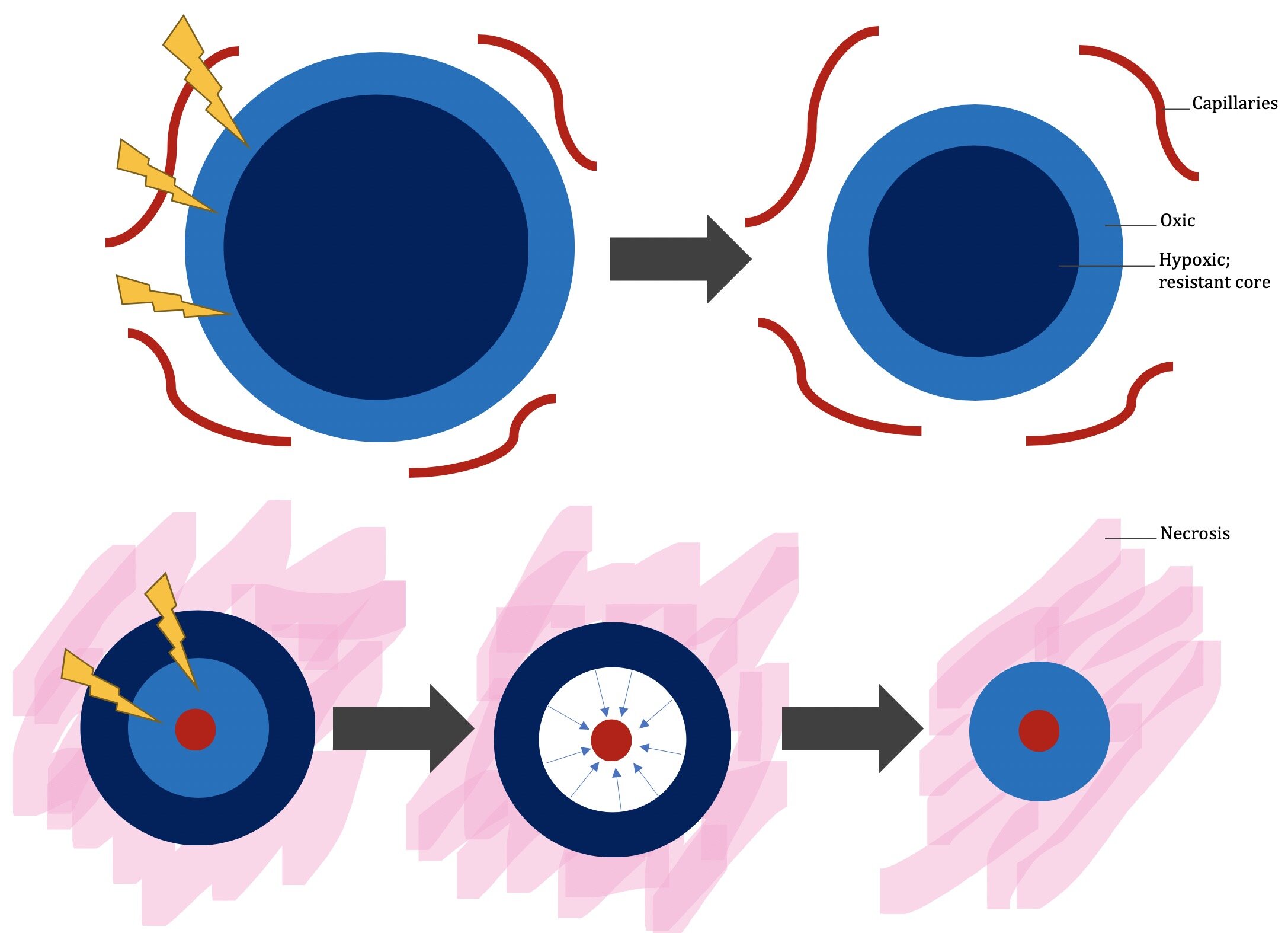 The 5Rs of Radiotherapy and Its Relationship with Tumour Cells ...