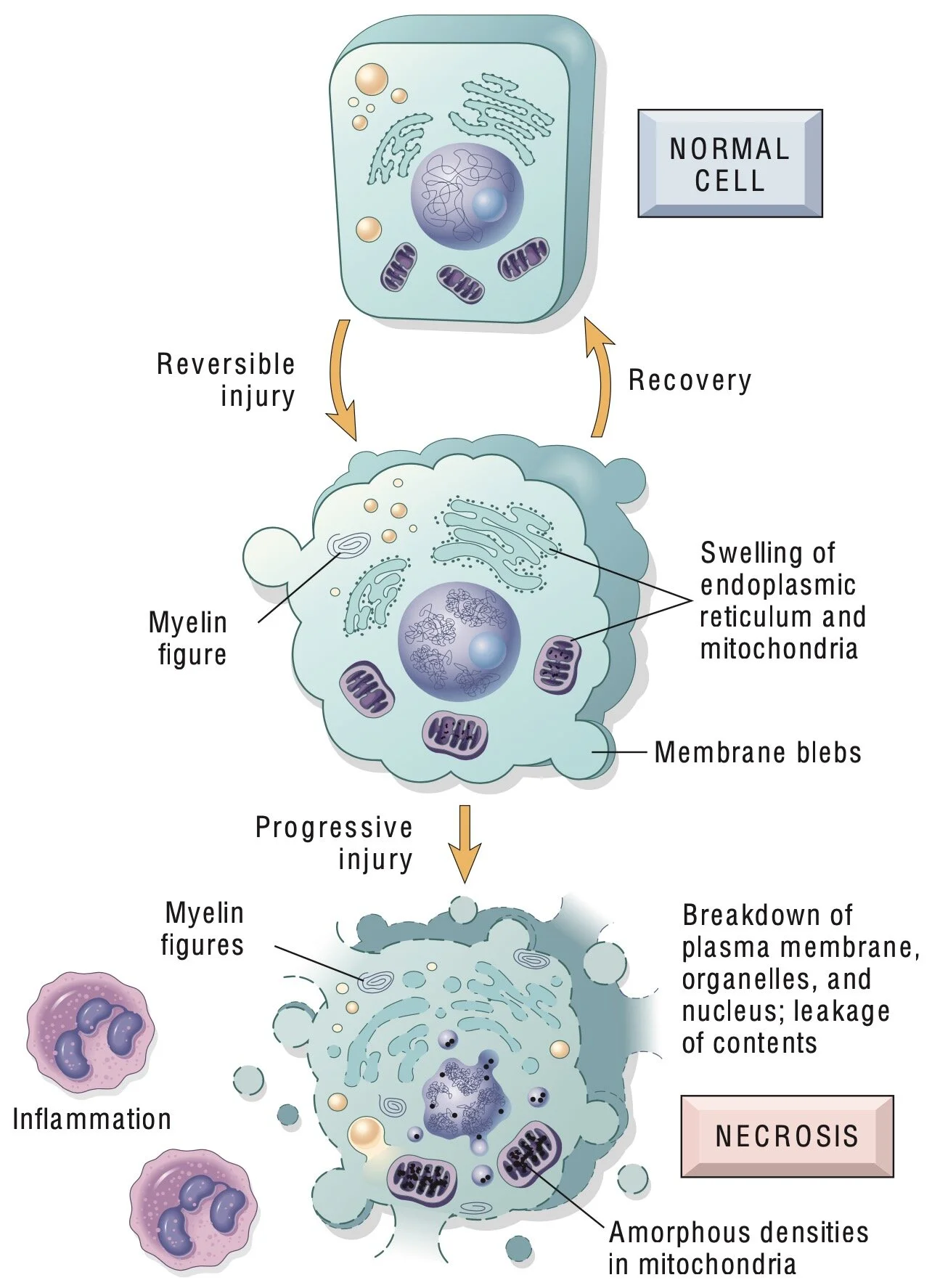 Necrosis and Apoptosis — What Are the Differences and Their ...