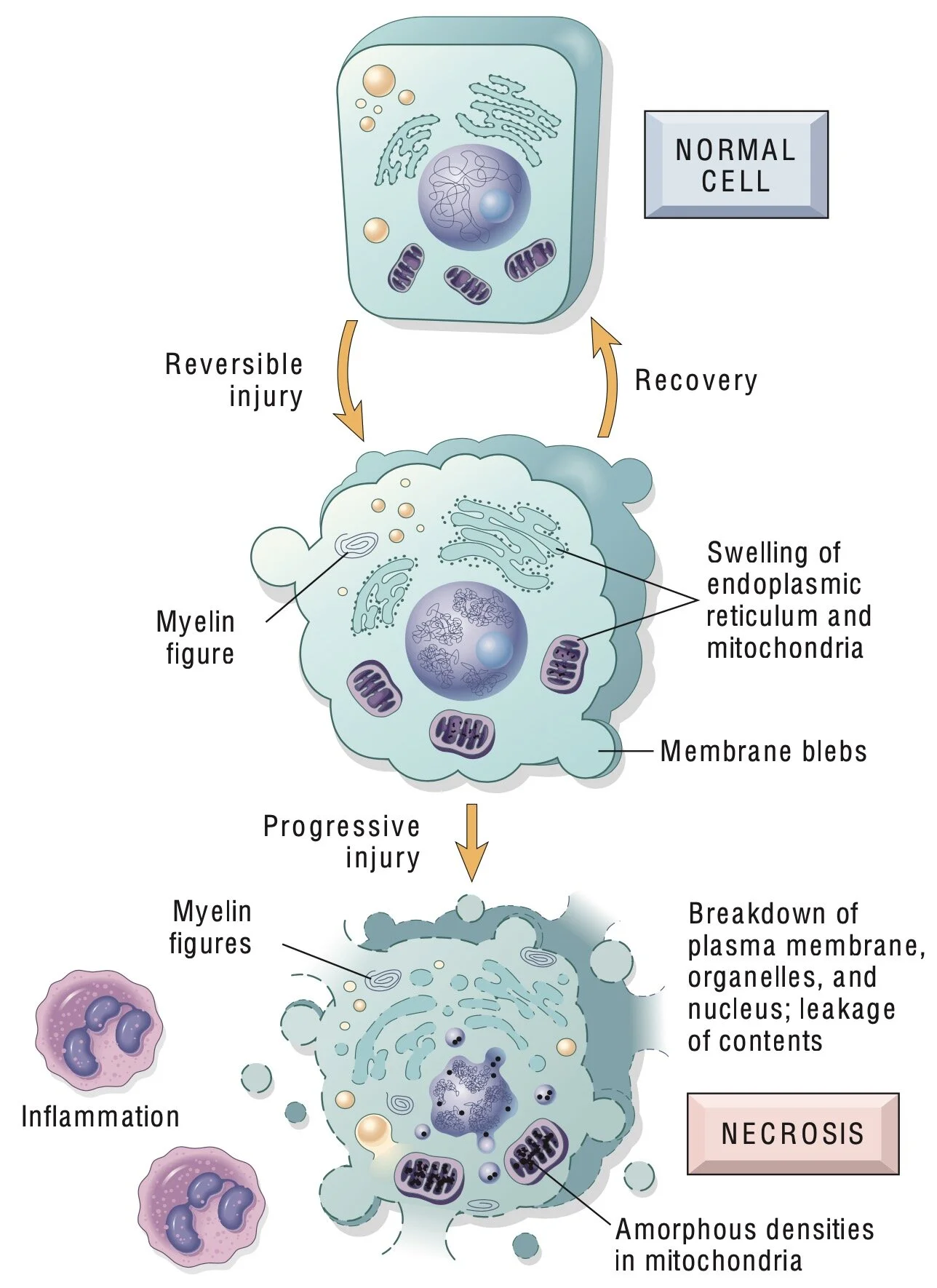 The Different Types of Necrosis and Their Histological Identifications ...