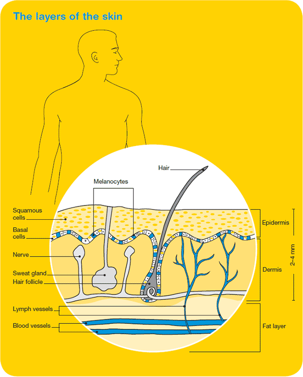 Main Type of Skin Cancer — Their Differences, Histology and Prevention ...