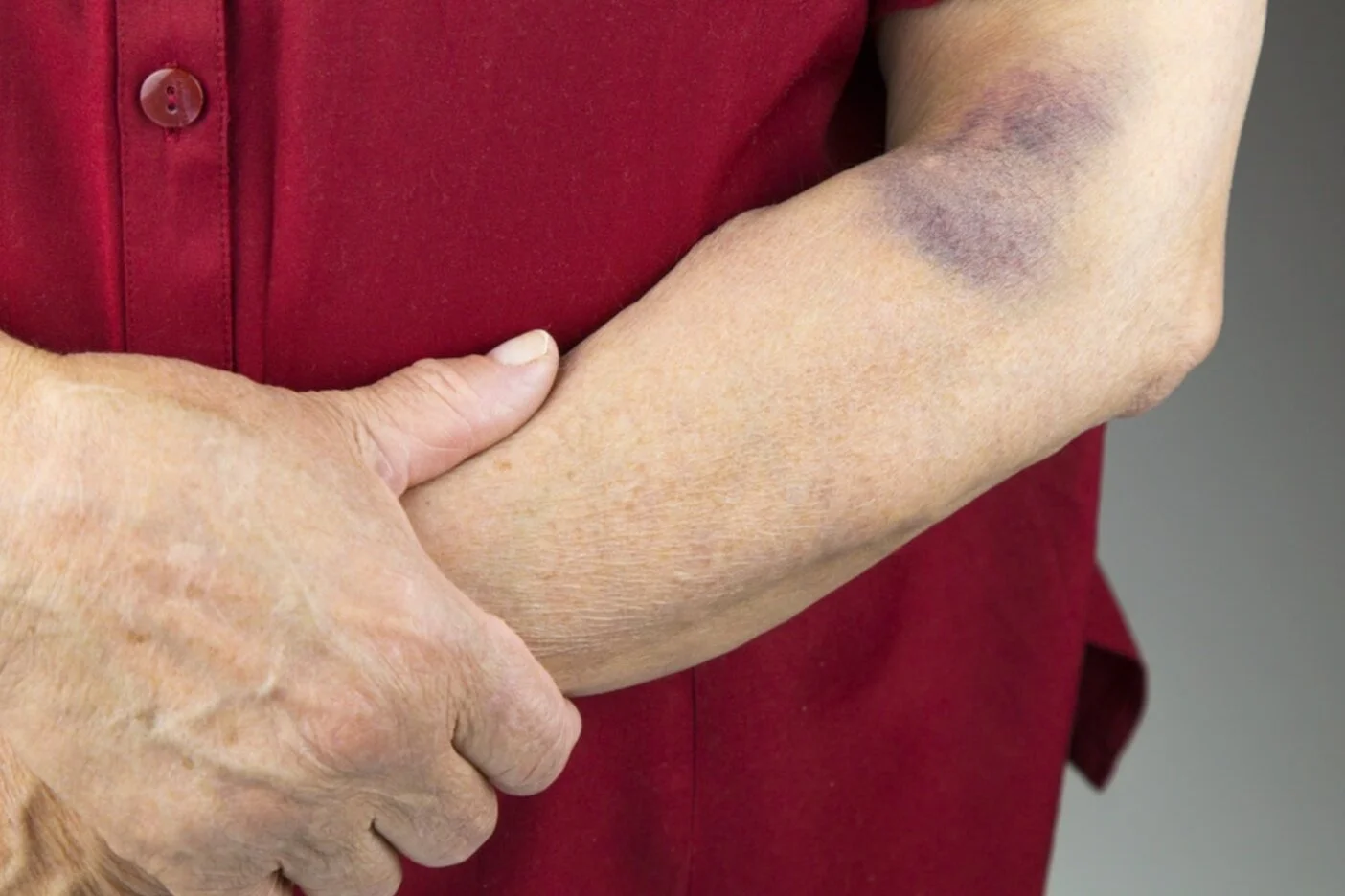 Chest Discomfort, Night Cough and Easy Bruising — The Important ...