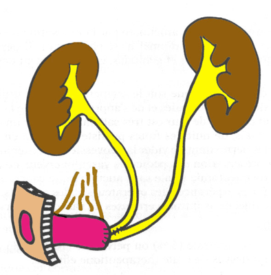 Dérivation urinaire — Urologie Grand Est Paris