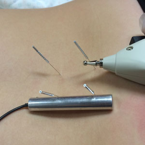 PT Services: Dry Needling, Shockwave & Sports Rehab | Wasatch PT