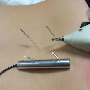 PT Services: Dry Needling, Shockwave & Sports Rehab | Wasatch PT