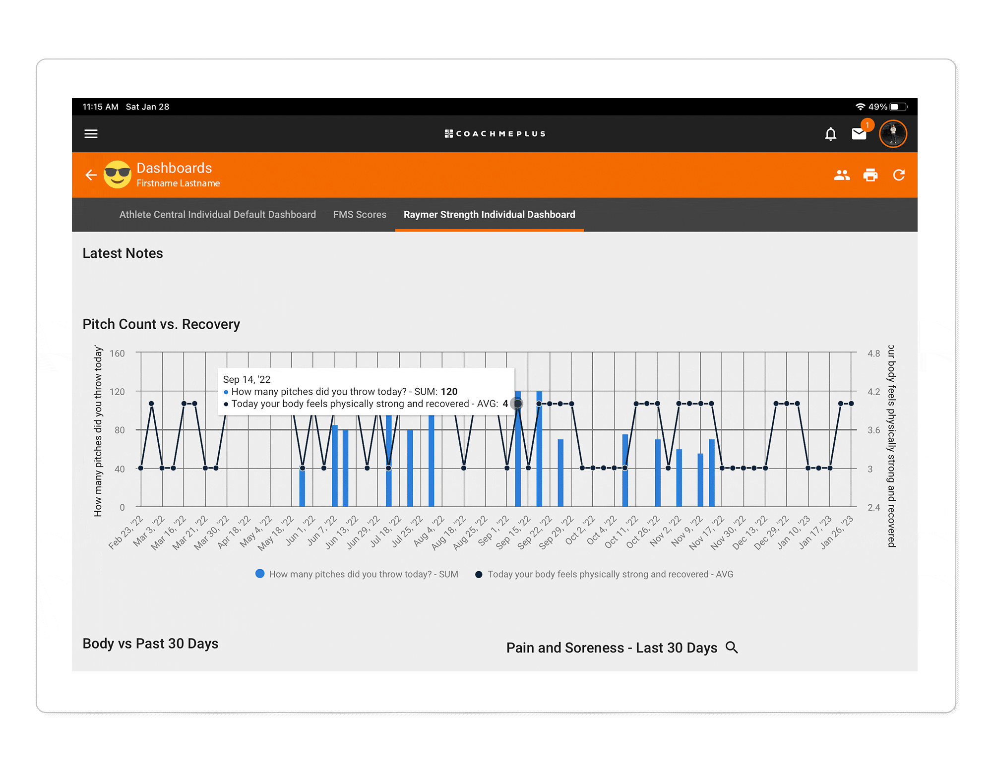 New Dashboard: Tracking Softball Pitch Count vs. Recovery — Raymer ...