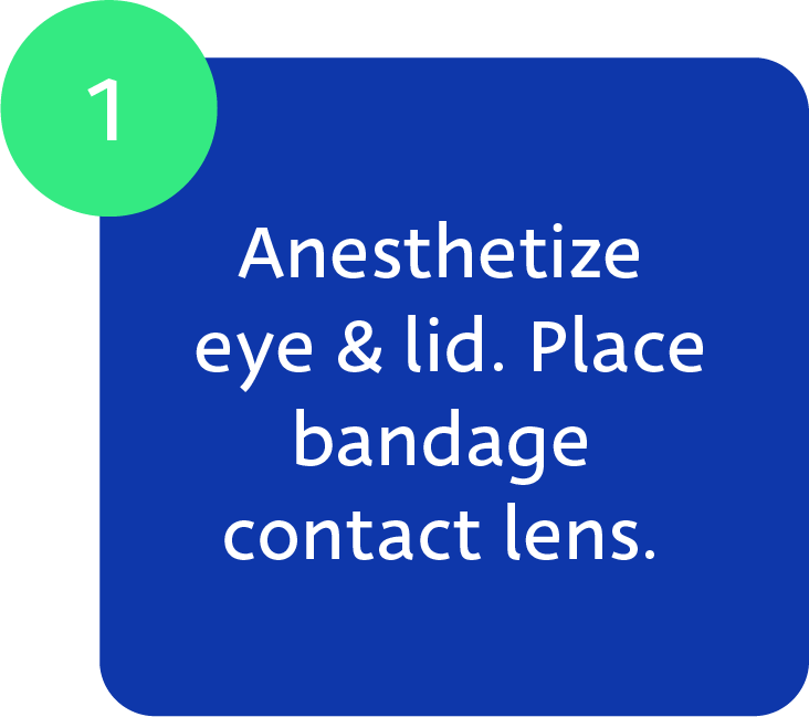 Maskin Meibomian Gland Probing: For Physicians — MGDinnovations