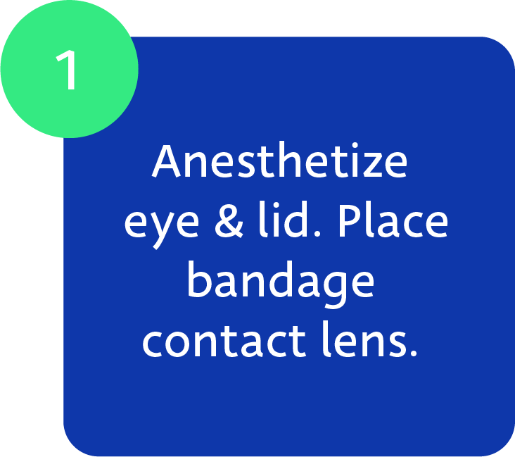 Maskin Meibomian Gland Probing: For Physicians — MGDinnovations