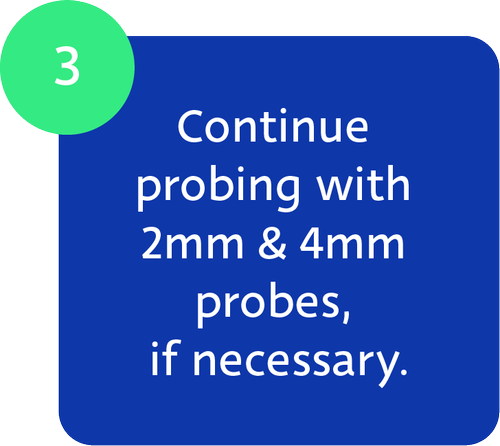 Maskin Meibomian Gland Probing: For Physicians — MGDinnovations