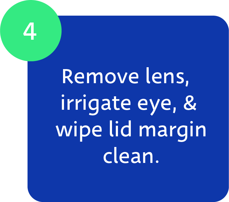 Maskin Meibomian Gland Probing: For Physicians — MGDinnovations