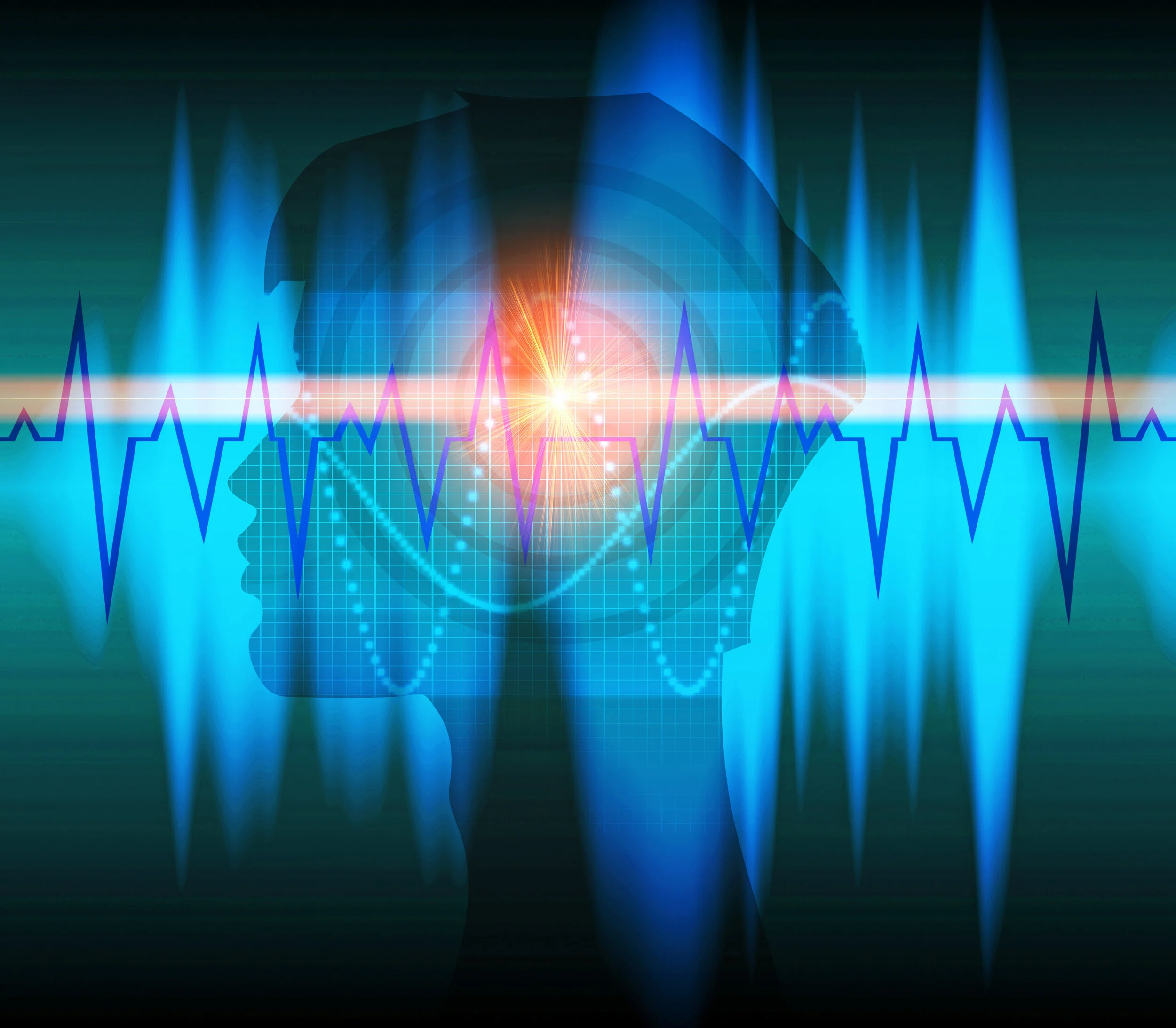 Microcurrent Neurofeedback — Elevate Wellness Center