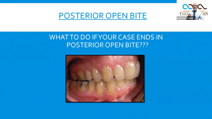 Invisalign’s New G8 Innovations Explained in English — AACA | The ...