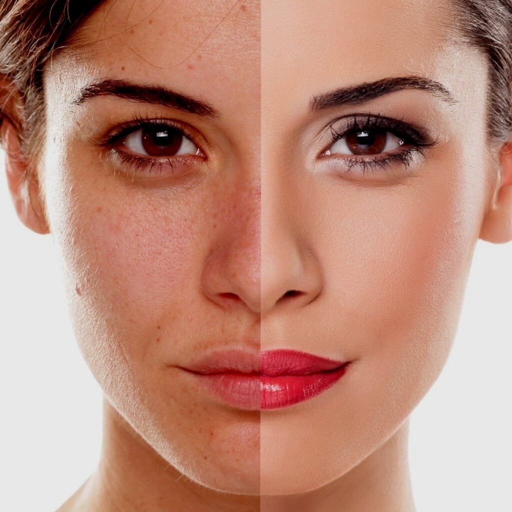 Laser Facials | Encinitas & Carlsbad CA | REJUV