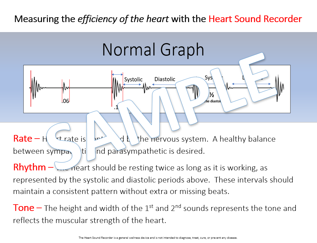 Welcome to Our Store — Heart Sound Recorder