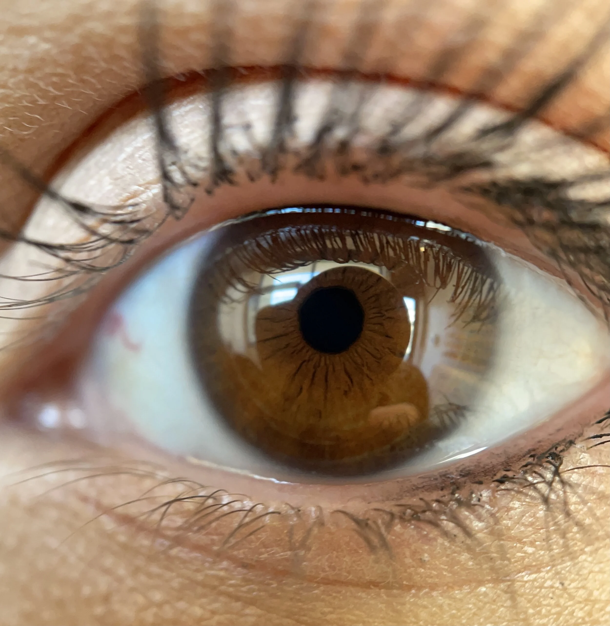 ALL THINGS LASIK — Spectacle Optometry