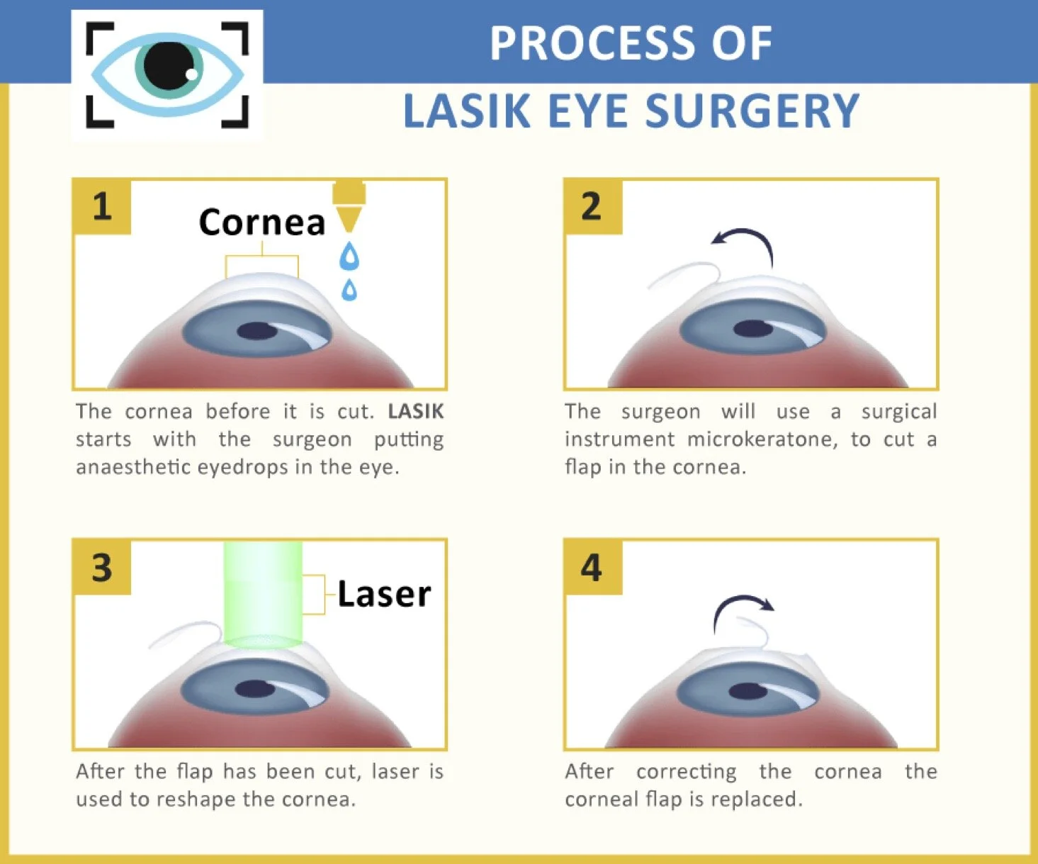 ALL THINGS LASIK — Spectacle Optometry