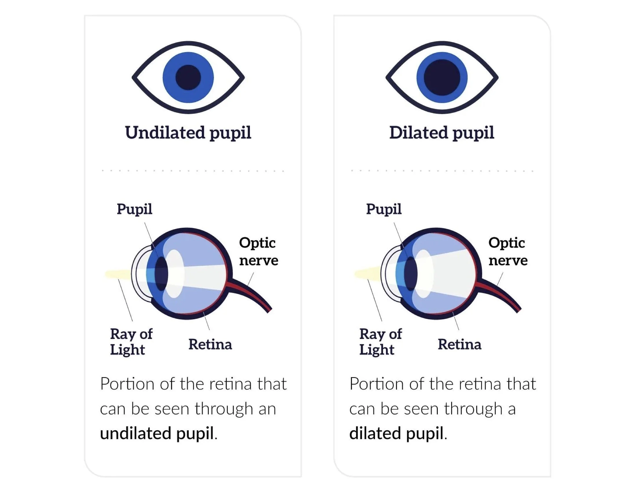 I'VE ONLY GOT EYES FOR YOU! — Spectacle Optometry