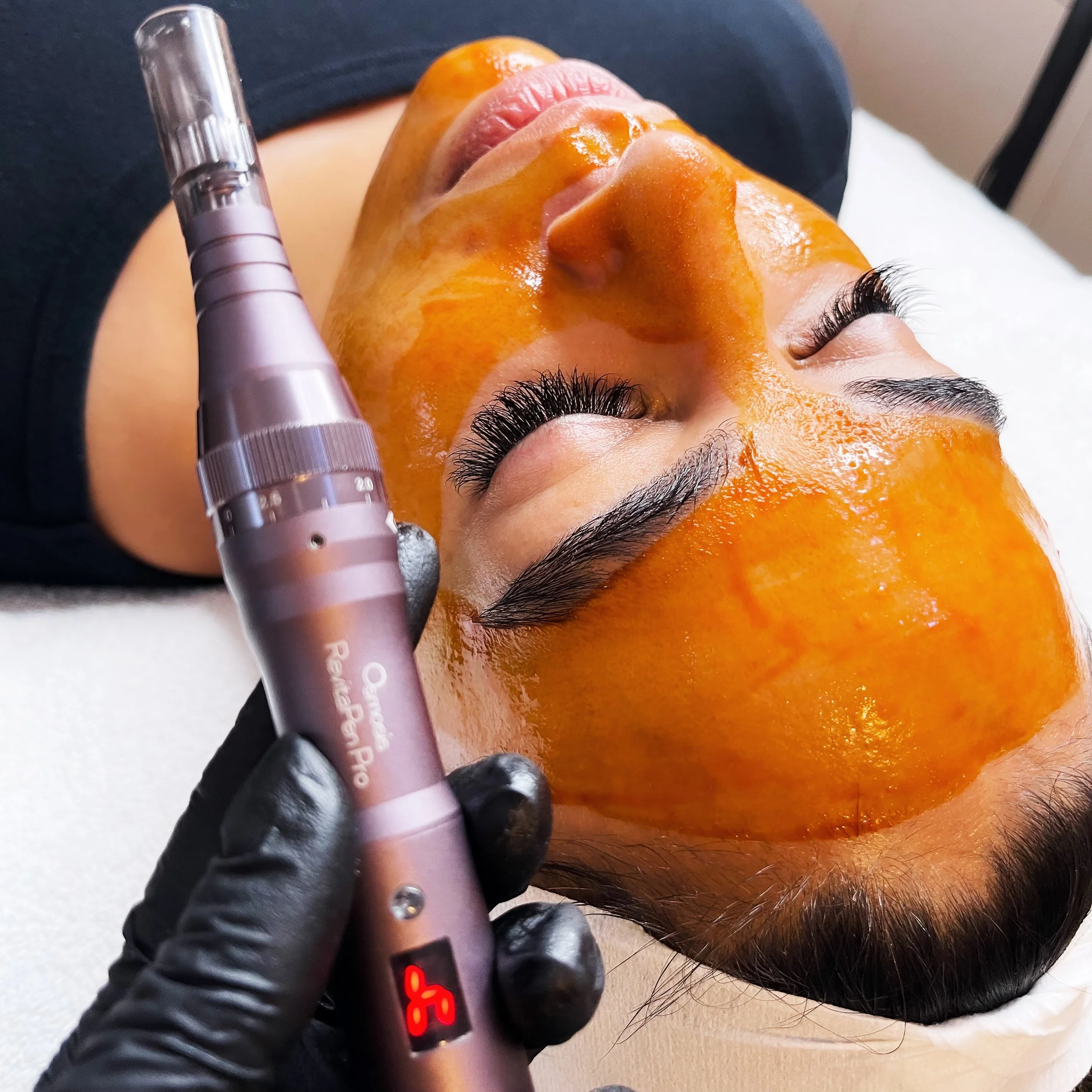 ReVitaPen Osmosis Facial Infusion — Downtown Smooth Spa