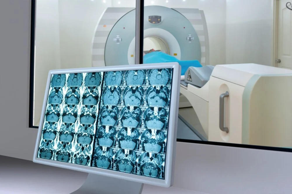The Parathyroid 4D-CT Scan – For Quick, Accurate Discovery — Radiology ...