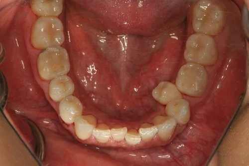 Before & After Smiles — Core Smiles NYC