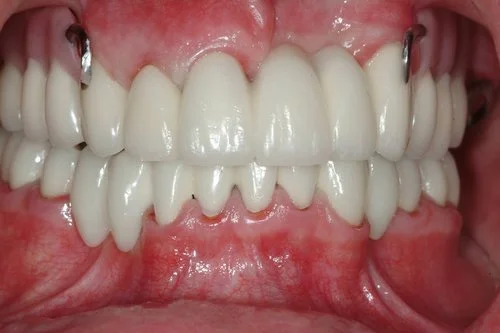 Before & After Smiles — Core Smiles NYC