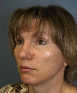 Face Procedures — Linda Huang, MD: Top Denver Plastic Surgeon