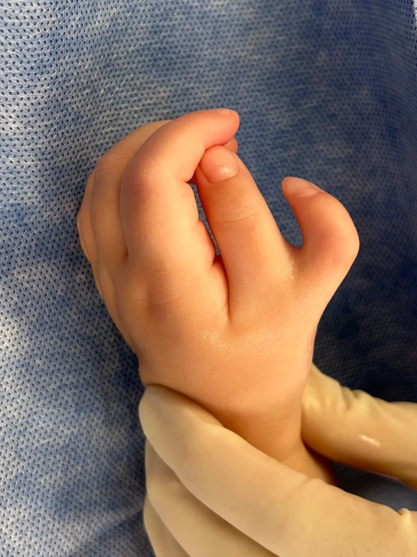 Congenital Differences — LittleArms.org