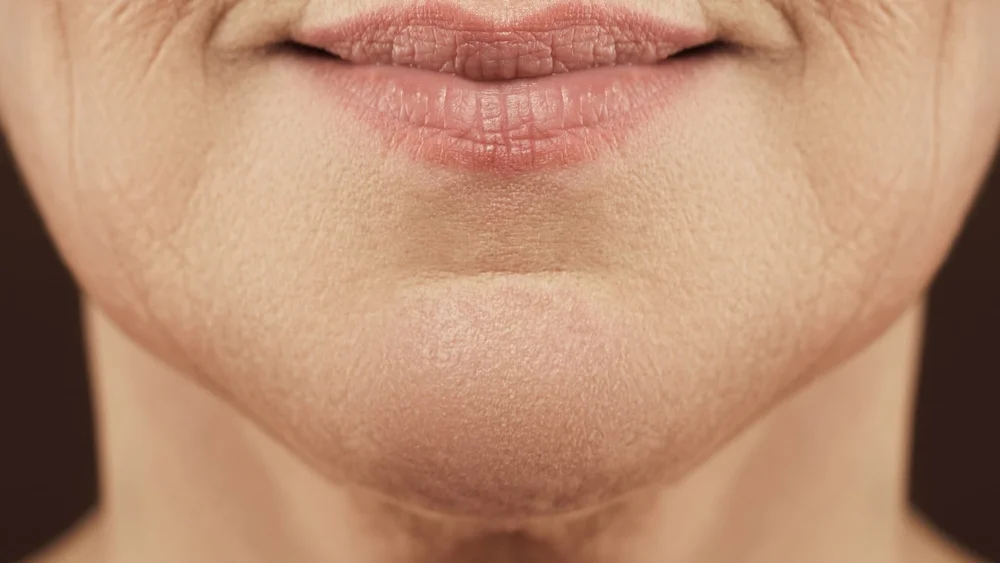 Signs of Premature Aging Explained by a Skincare Expert | Kim Gallo ...