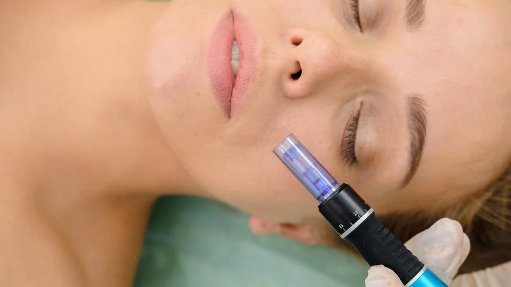 How to Increase New Collagen Production: Nutrition and Microneedling ...