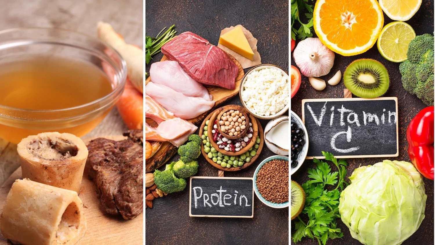 How to Increase New Collagen Production: Nutrition and Microneedling ...