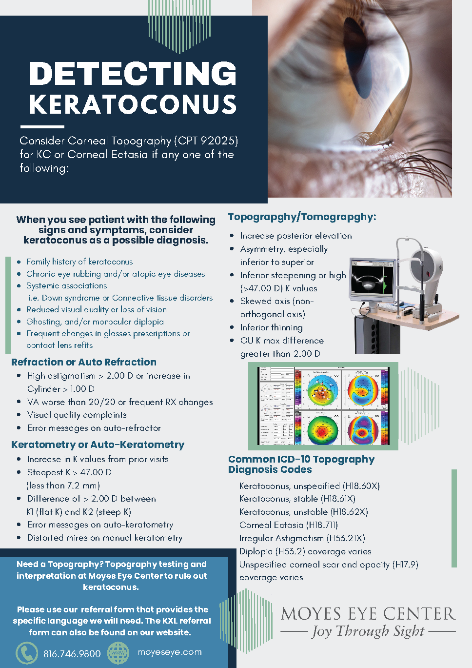 Keratoconus — Moyes Eye Center