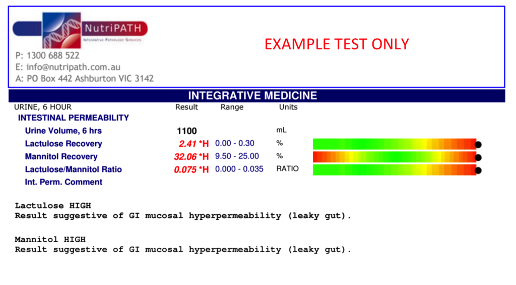 Leaky Gut - EVERYTHING You Need to Know