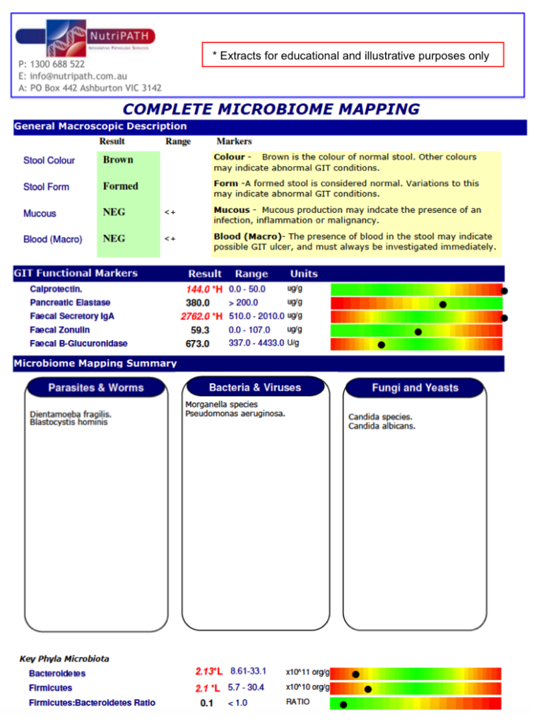 How to Test for IBS Root Causes
