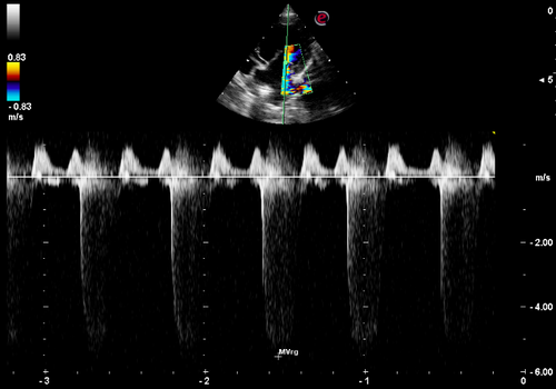 Mobile Veterinary Ultrasound- MiVU