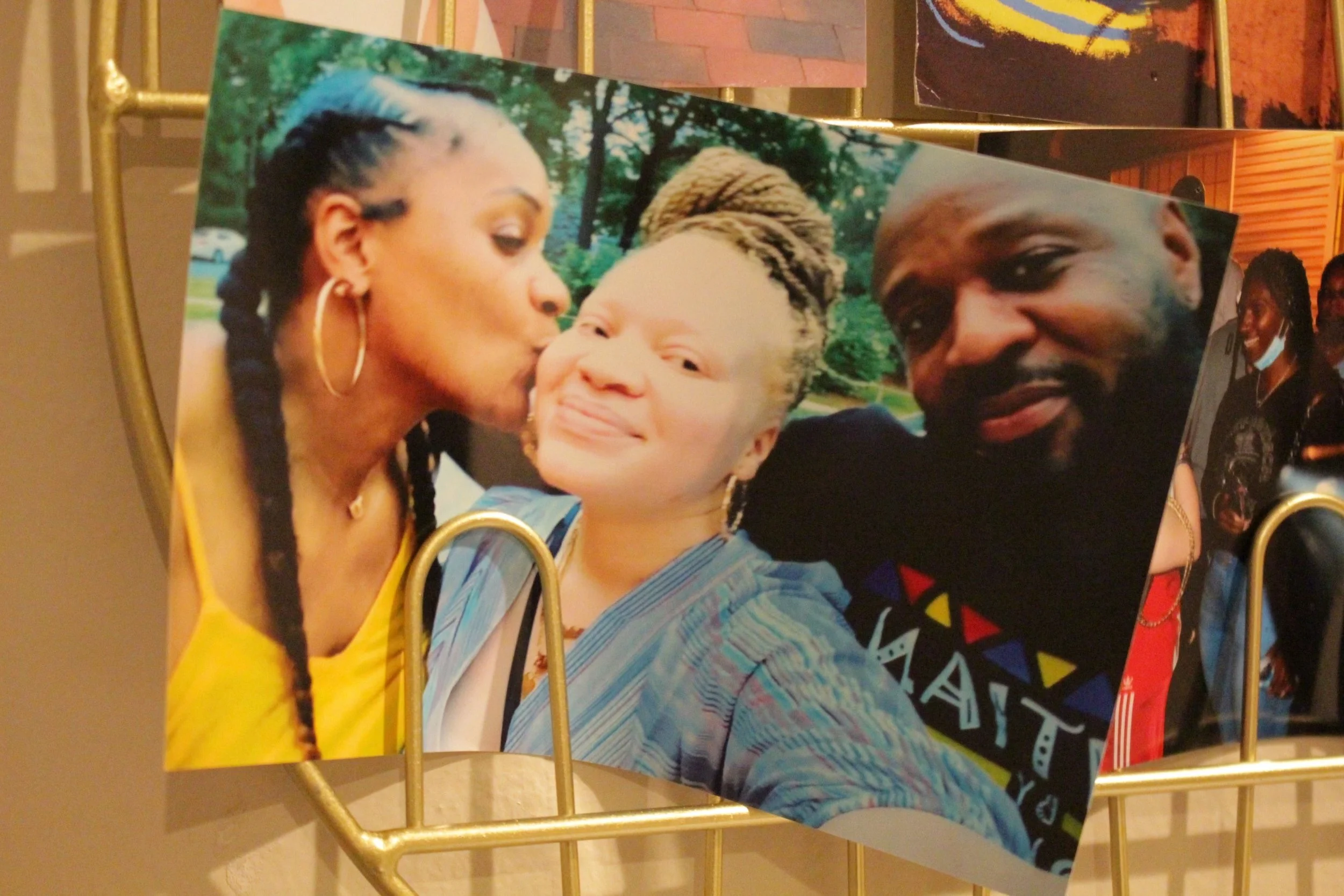 Exploring Black Identity Through Albinism — BLACK X BOLD