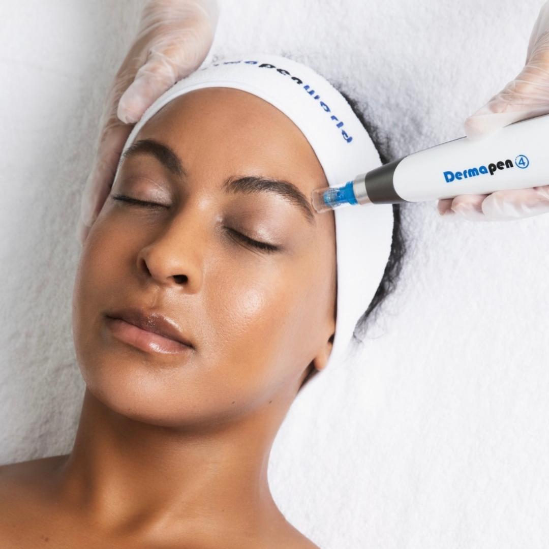 Skin Needling — Erin Aesthetics