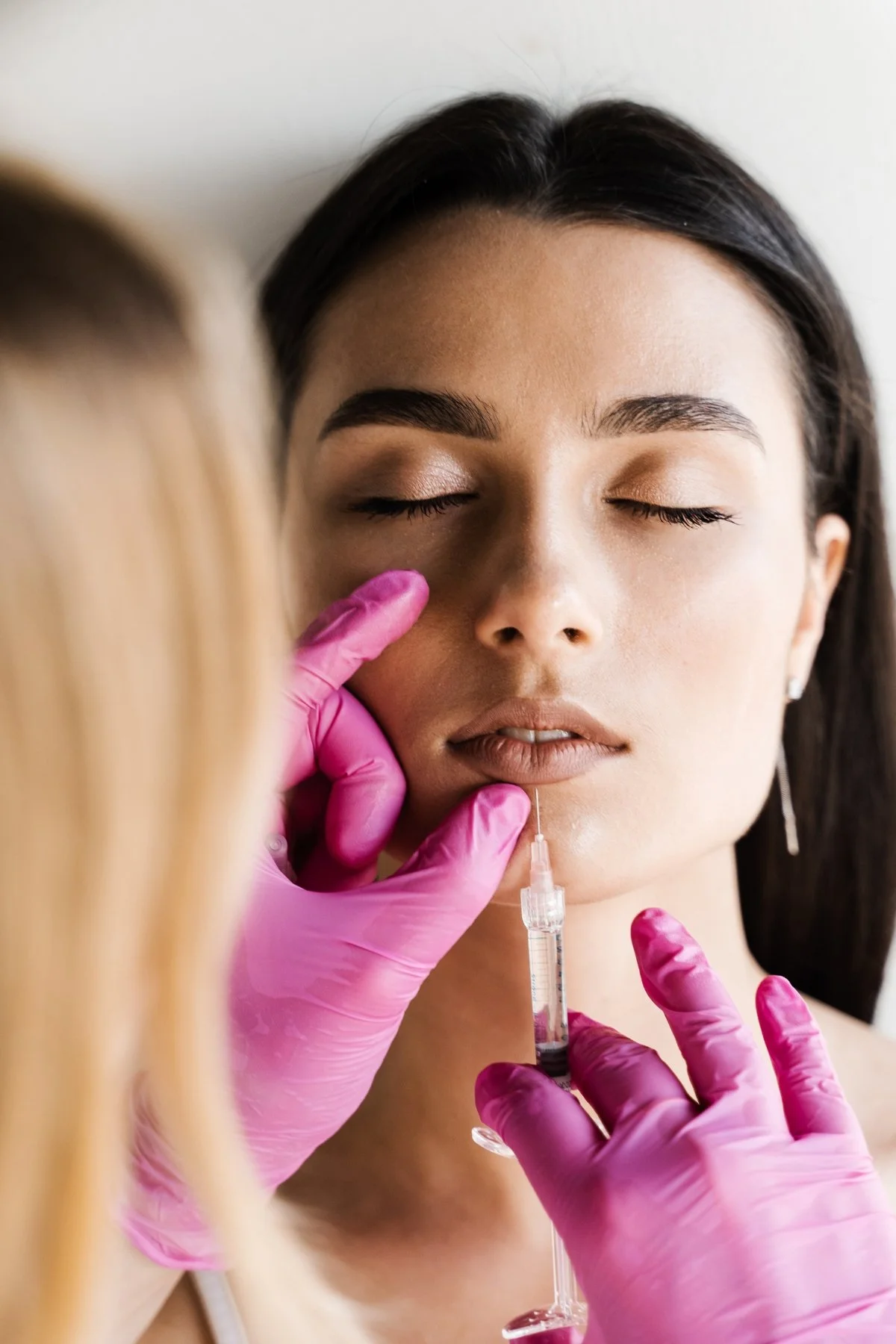Dermal Fillers and Biostimulatory Treatments in Saratoga Springs — Bellatas