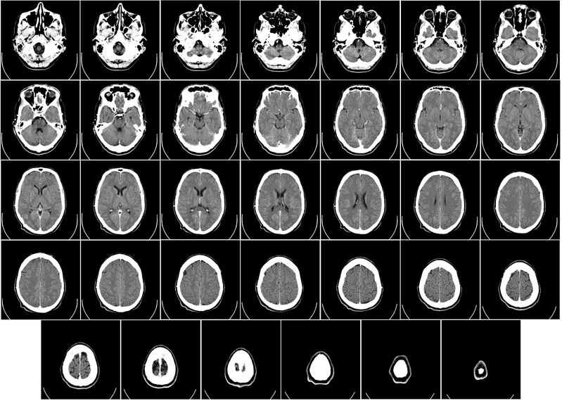 Brain Structure and Function (A Level) — the science sauce
