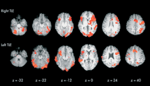 Brain Structure and Function (A Level) — the science sauce