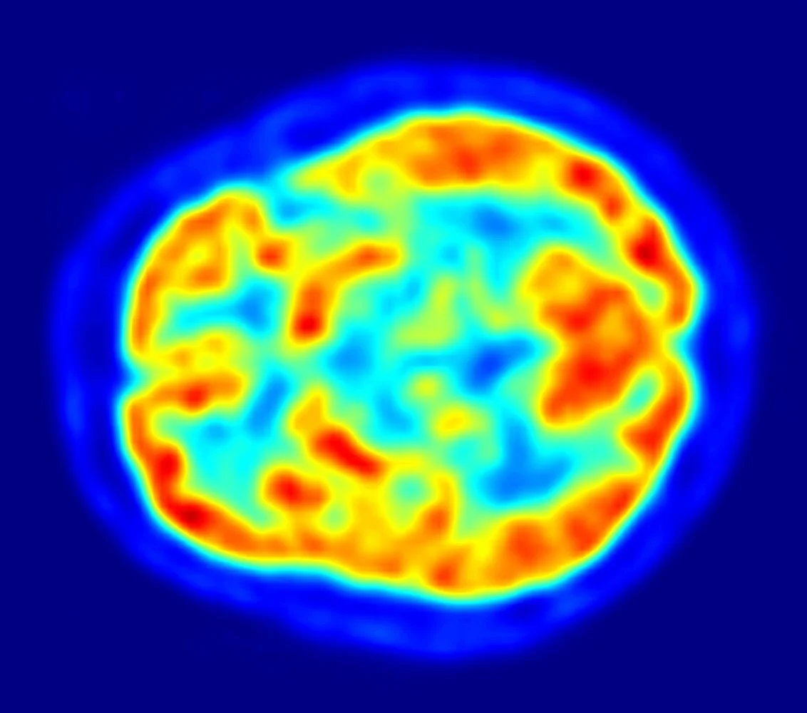 Brain Structure and Function (A Level) — the science sauce