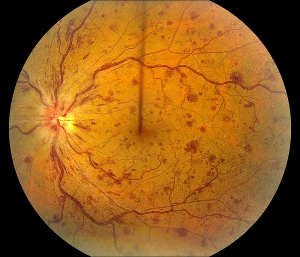 Ophthalmology Expert Witness Services