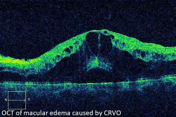 Ophthalmology Expert Witness Services