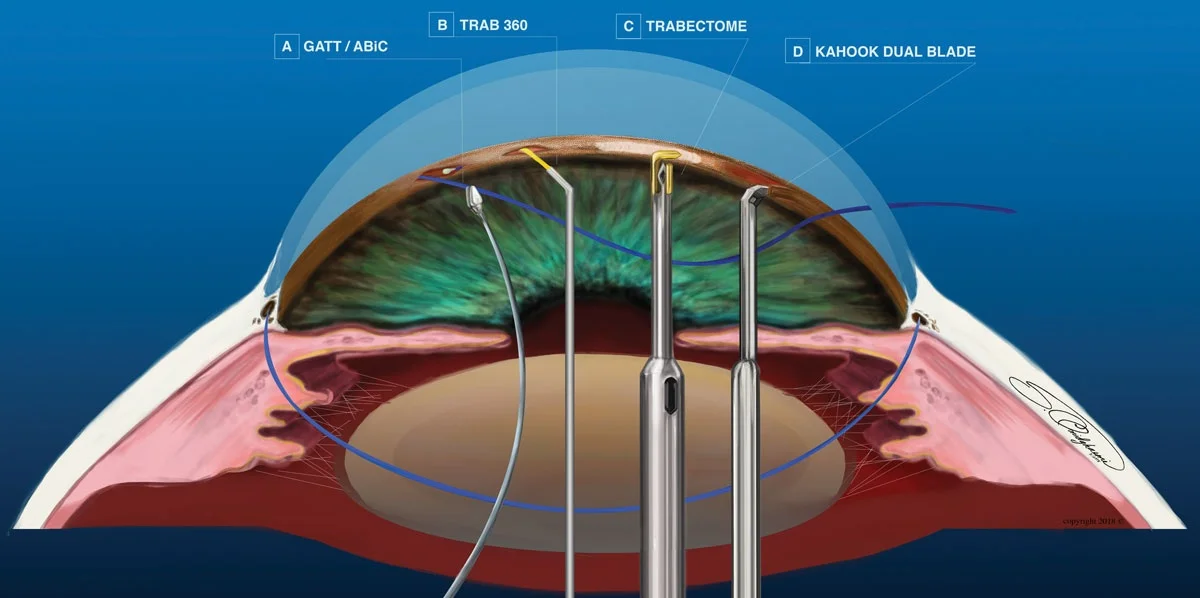 Ophthalmology Expert Witness Services