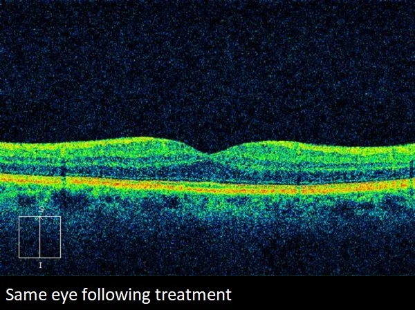 Ophthalmology Expert Witness Services