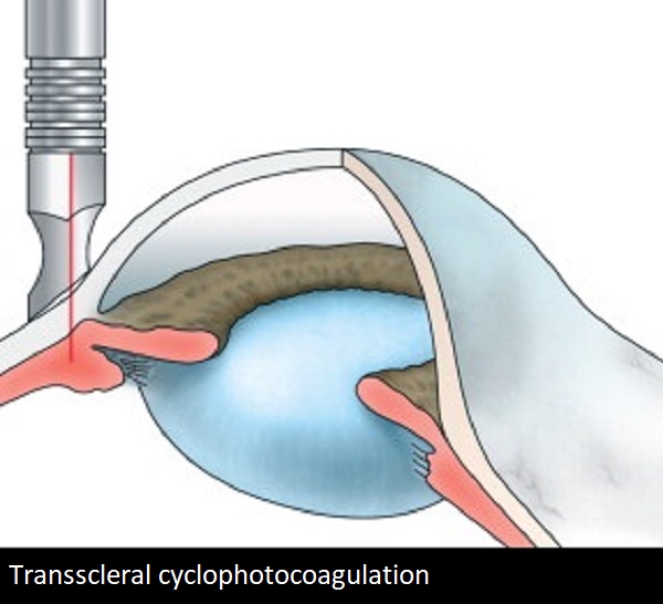 Ophthalmology Expert Witness Services