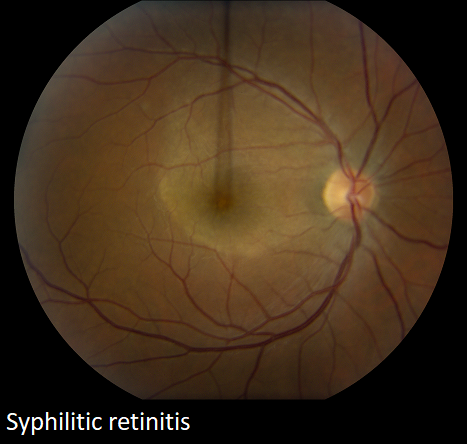 Ophthalmology Expert Witness Services